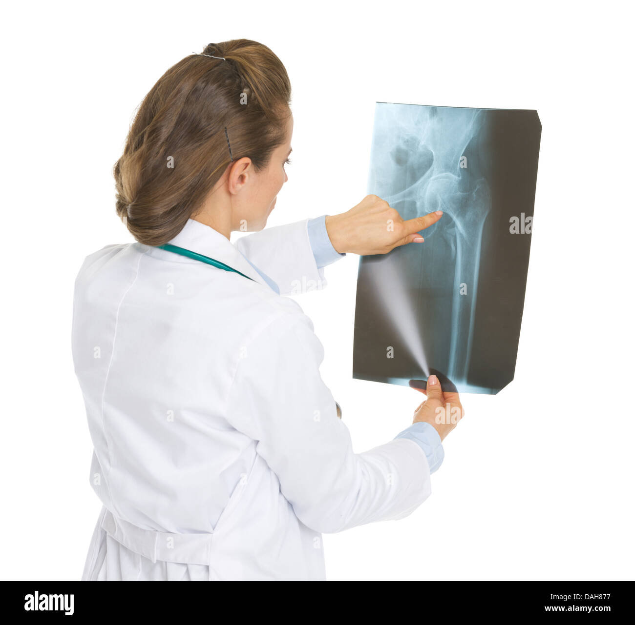 Doctor woman pointing on fluorography . rear view Stock Photo - Alamy