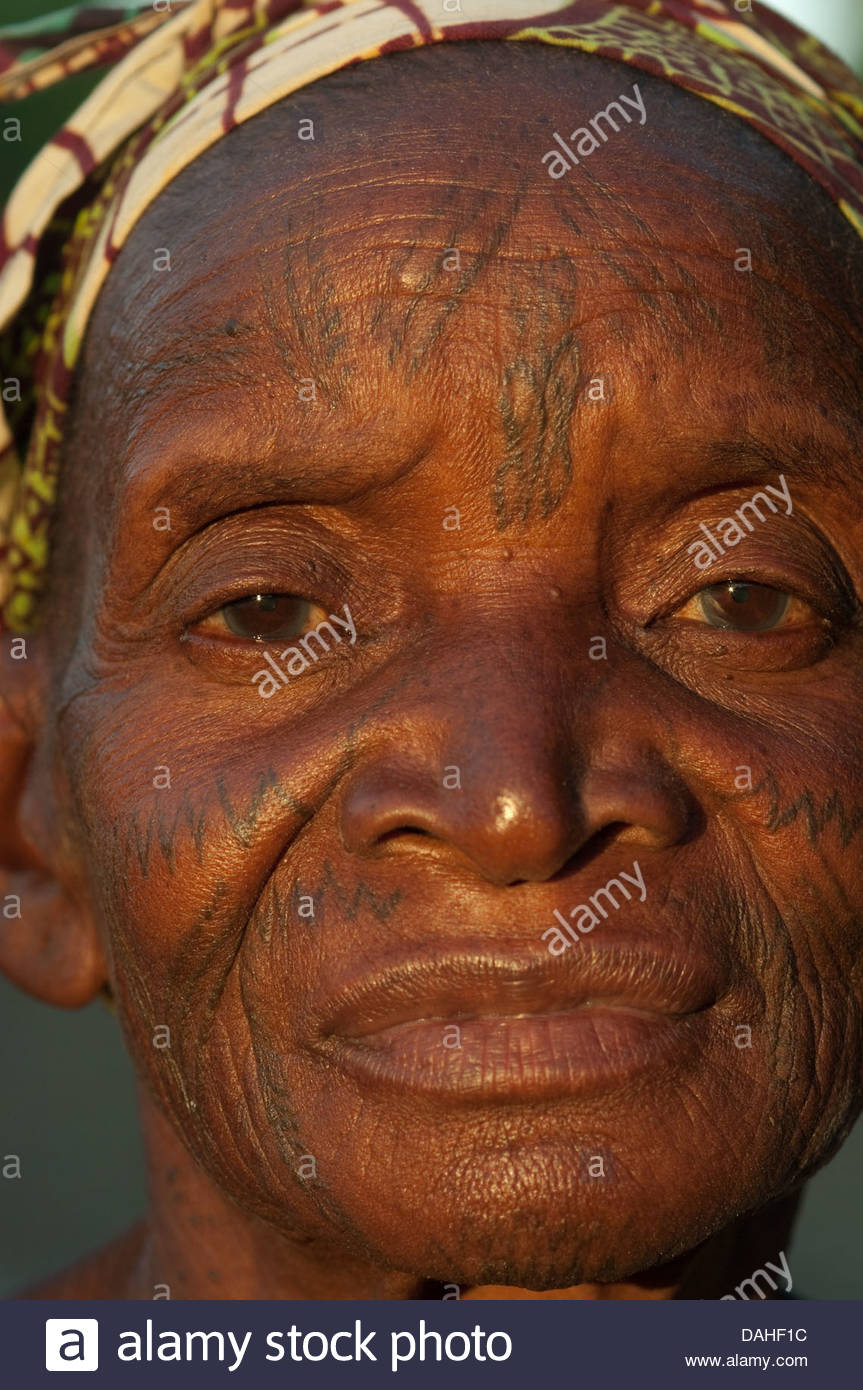 Facial Scarring Stock Photos & Facial Scarring Stock Images - Alamy