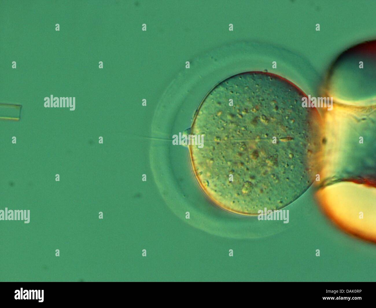 Microscope of sperm cell hi-res stock photography and images - Alamy