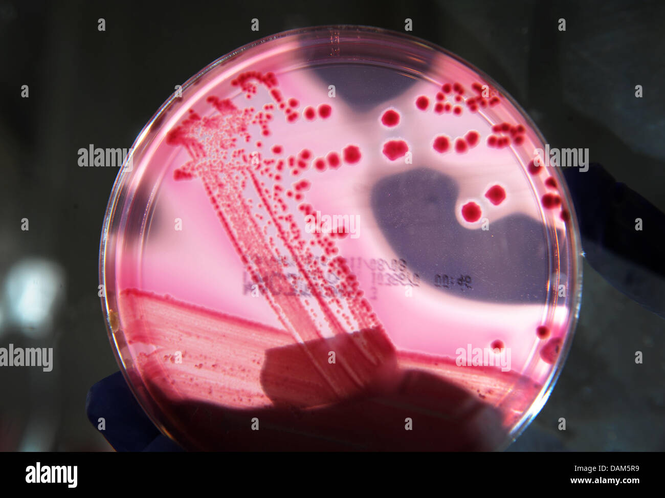 Medical technical assistant Brigitte Weiss holds a Petri dish that ...