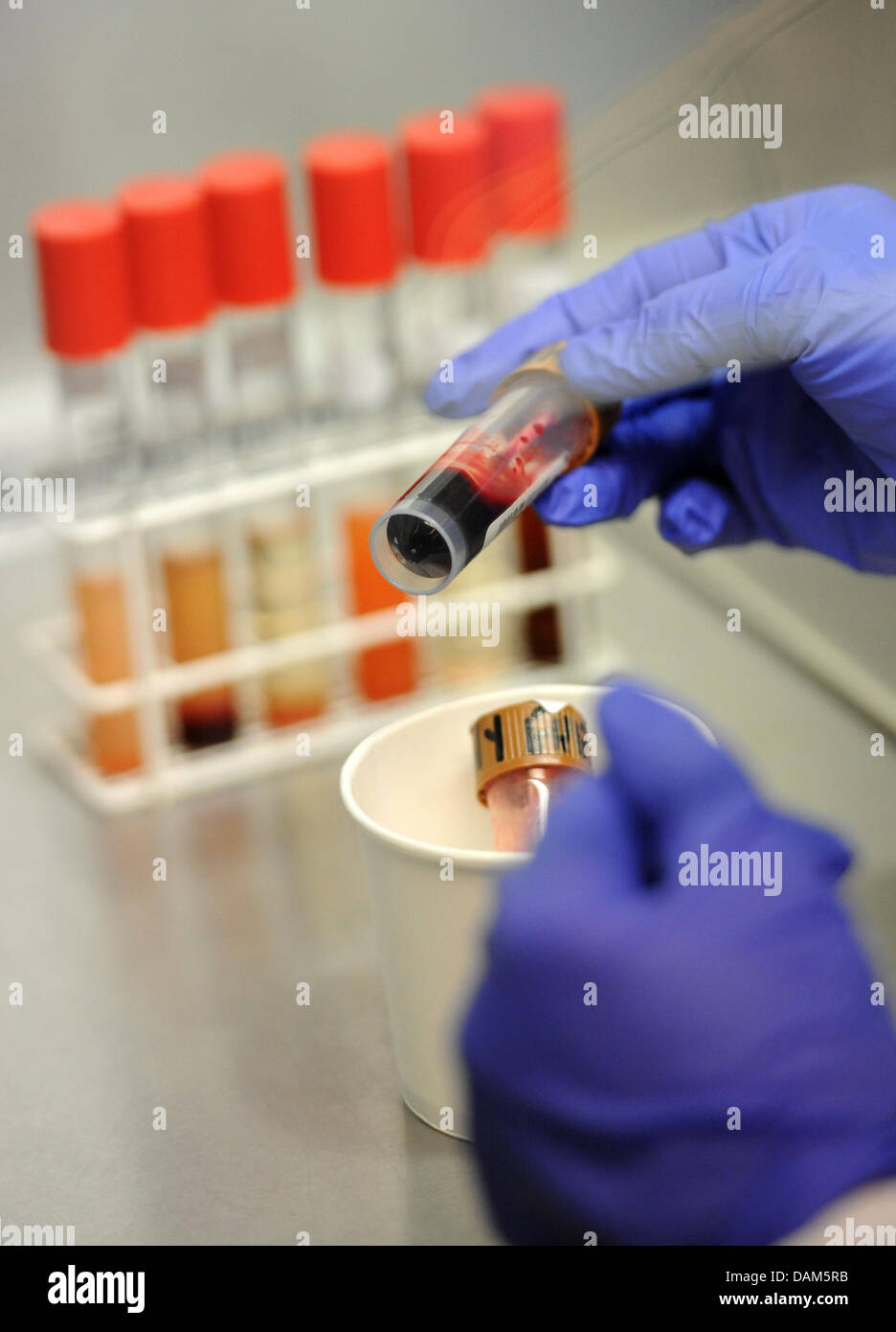A medical technical assistant handles stool samples that contain ...