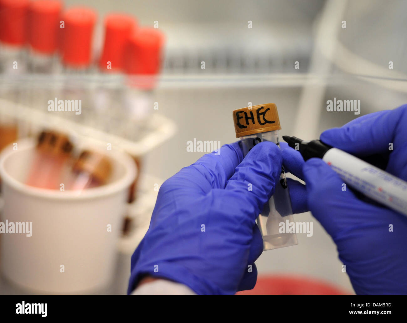 A medical technical assistant handles stool samples that might contain ...