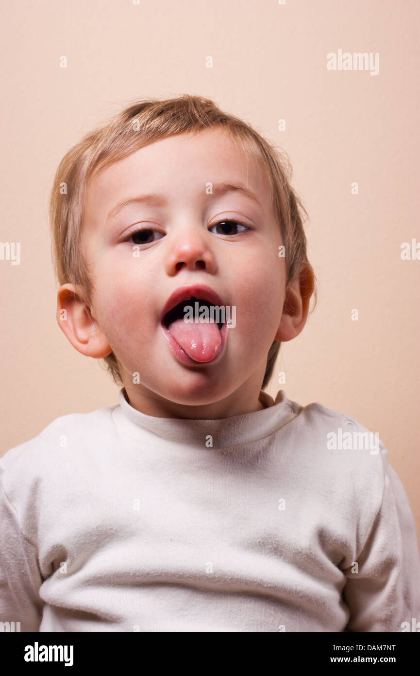 Tongue disease hi-res stock photography and images - Alamy
