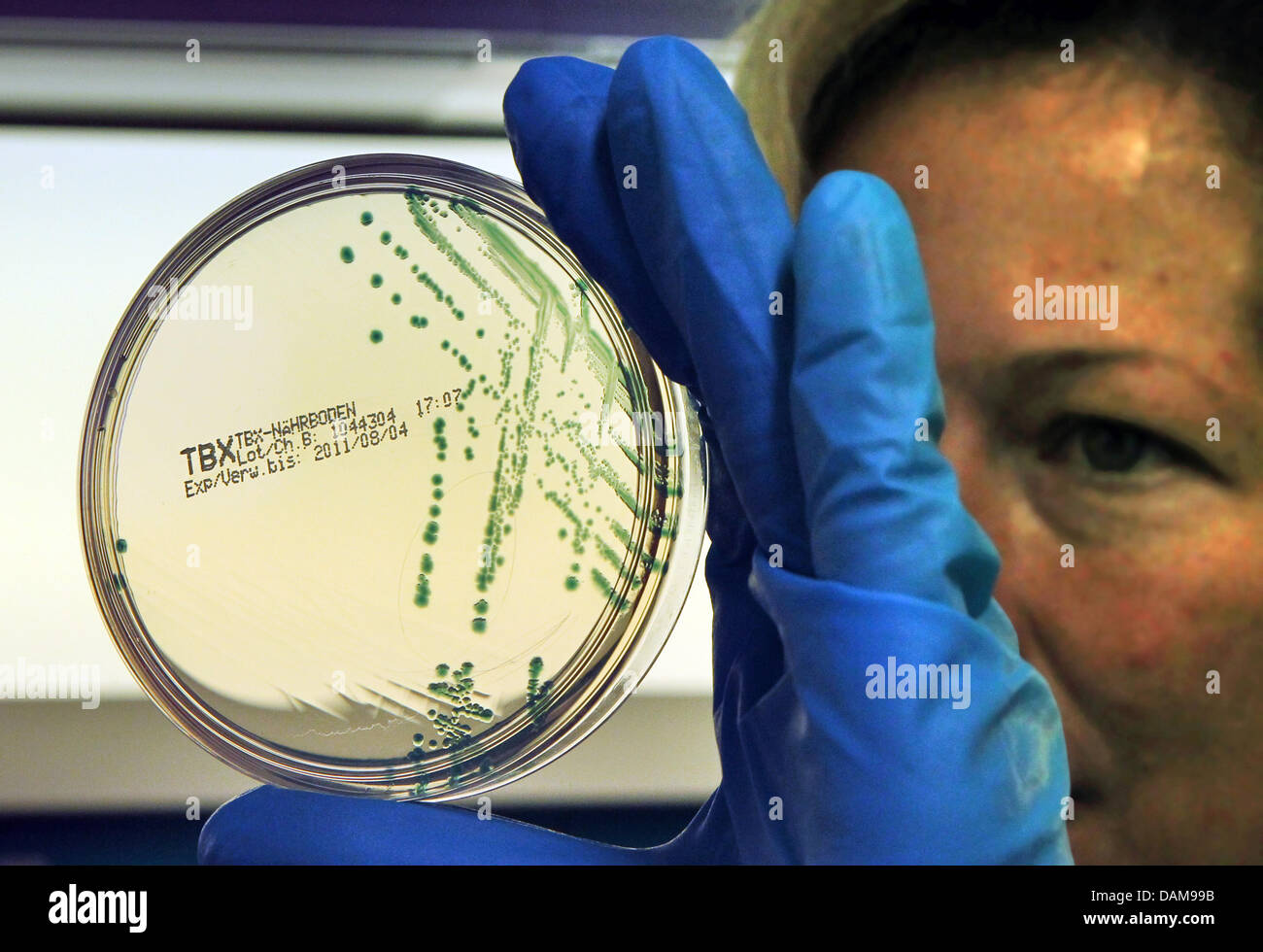 Due to the recent E. coli outbreak in germany, samples are tested for ...