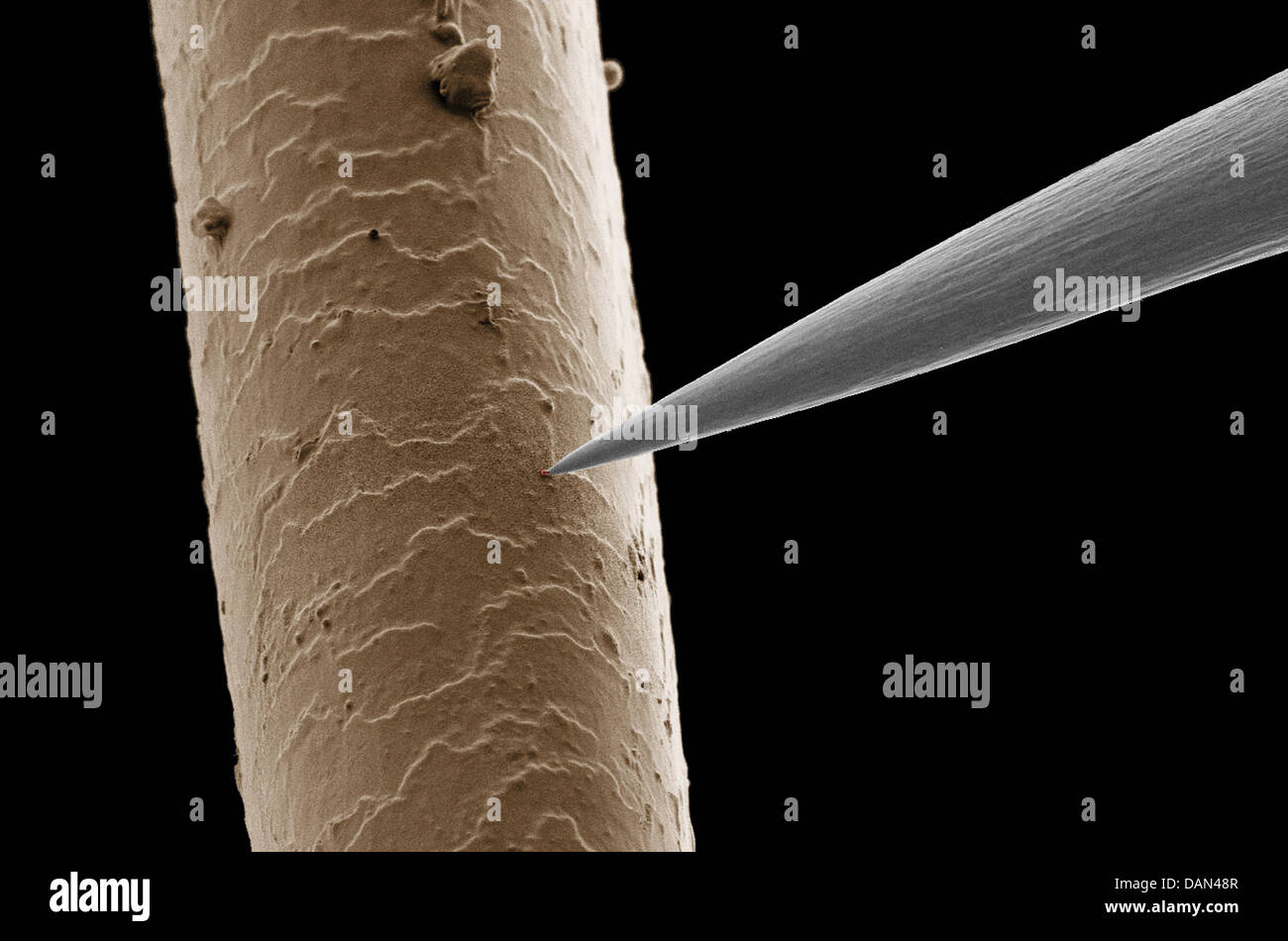 Damaged Human Hair Under Microscope