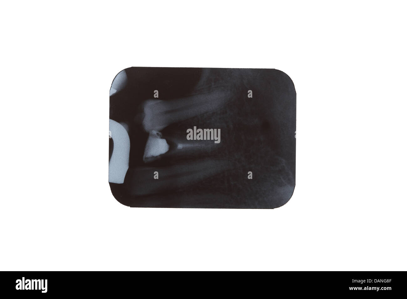 a dental x-ray film detail isolated on white Stock Photo - Alamy
