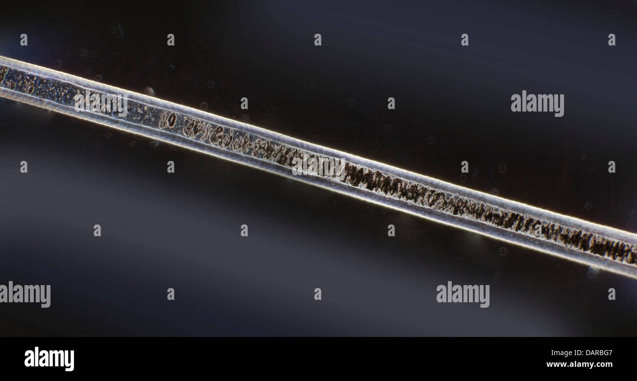 Micrograph hair hi-res stock photography and images - Alamy