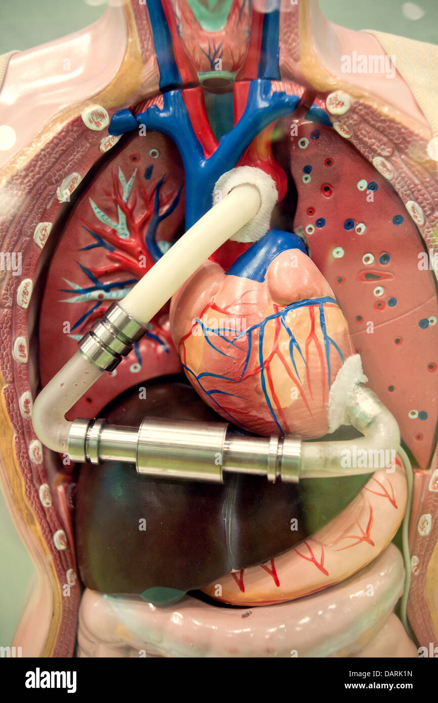 Artificial heart anatomy hi-res stock photography and images - Alamy