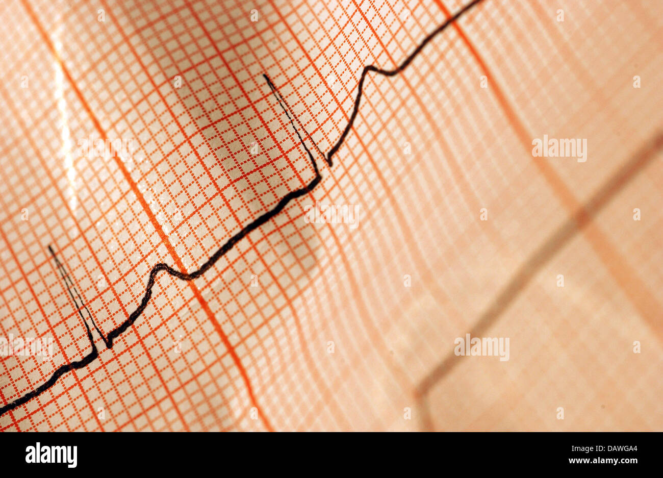 The printed out diagram of an electrocardiogram (ECG) is pictured in ...