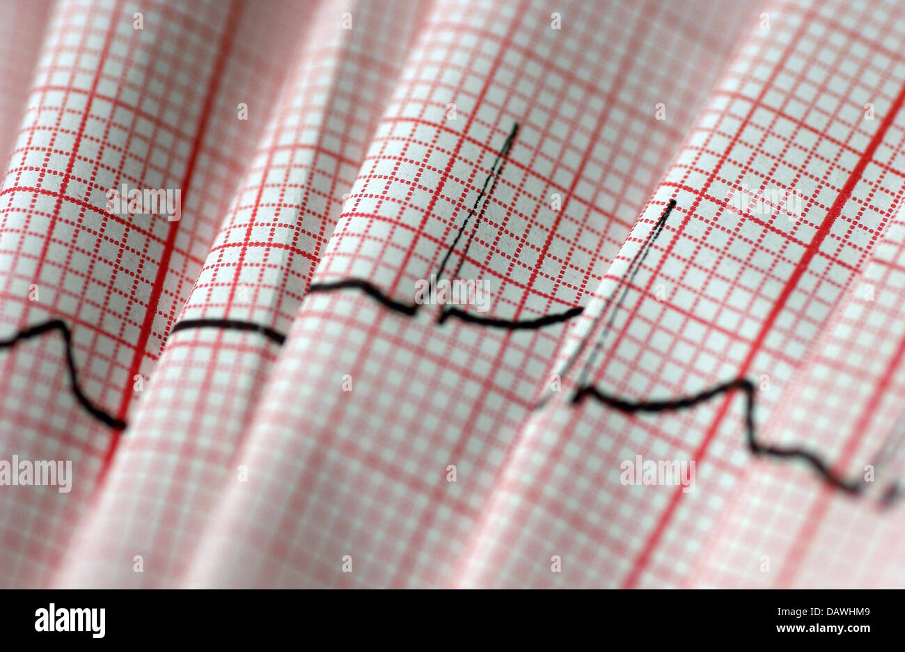 The undated picture shows the printout of an electrocardiogram (ECG) in ...