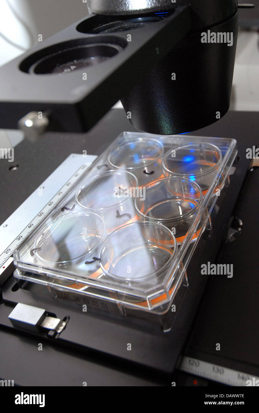 Culture with the HI virus pictured under an UV microscope in the ...