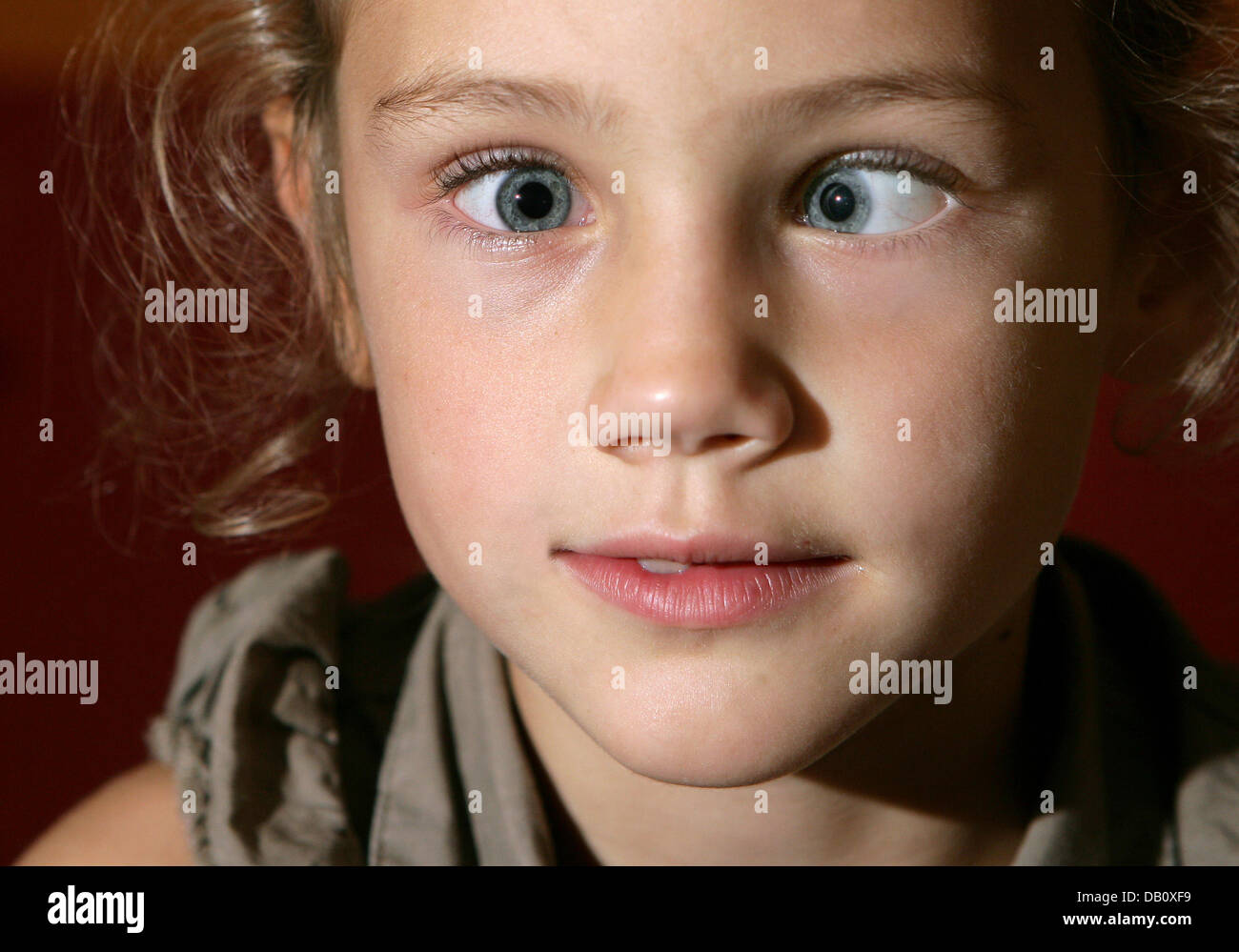 A little girl who suffers from Strabismus is pictured in Frankfurt Oder ...