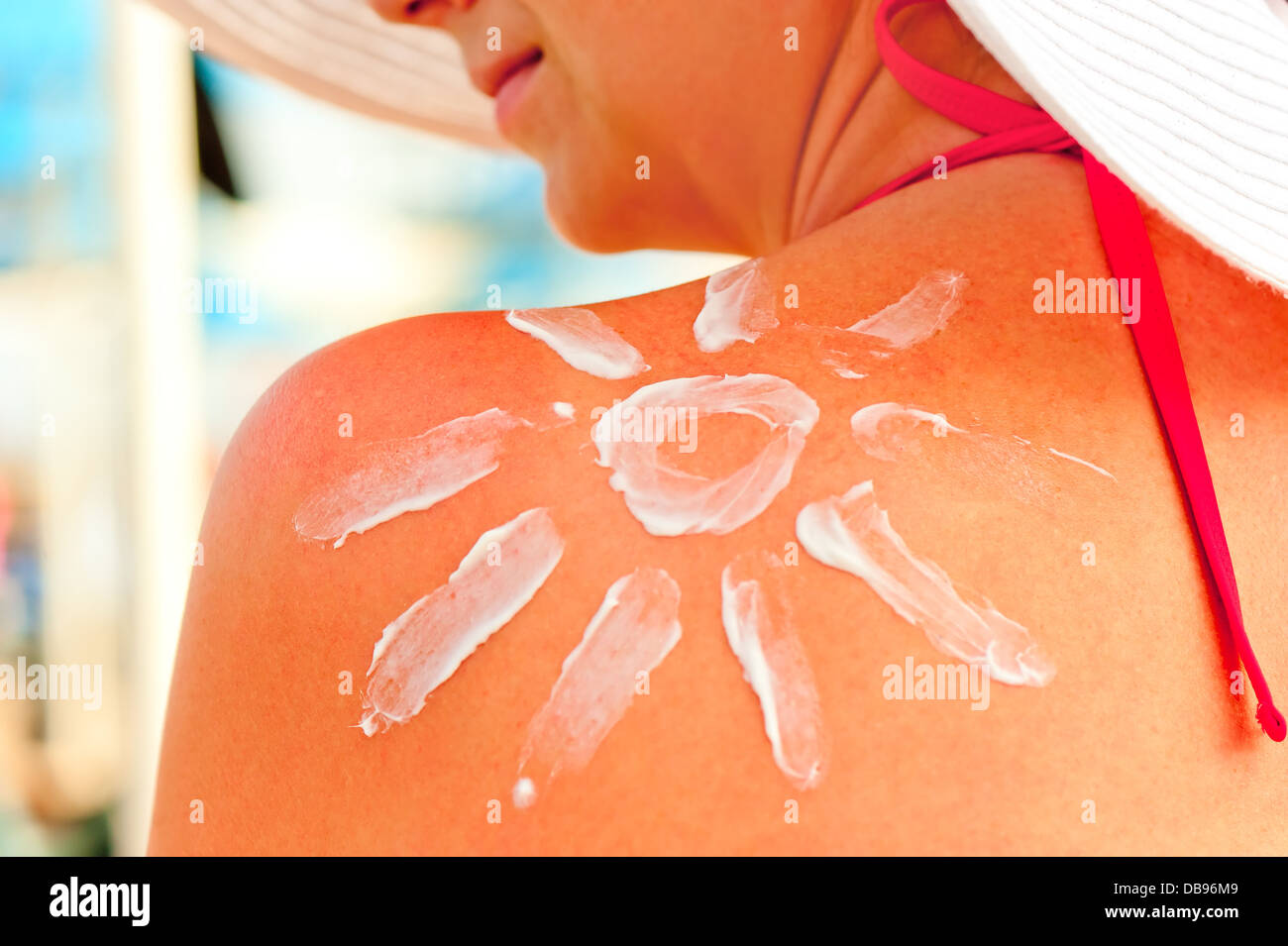 Sunburned woman cream hi-res stock photography and images - Alamy