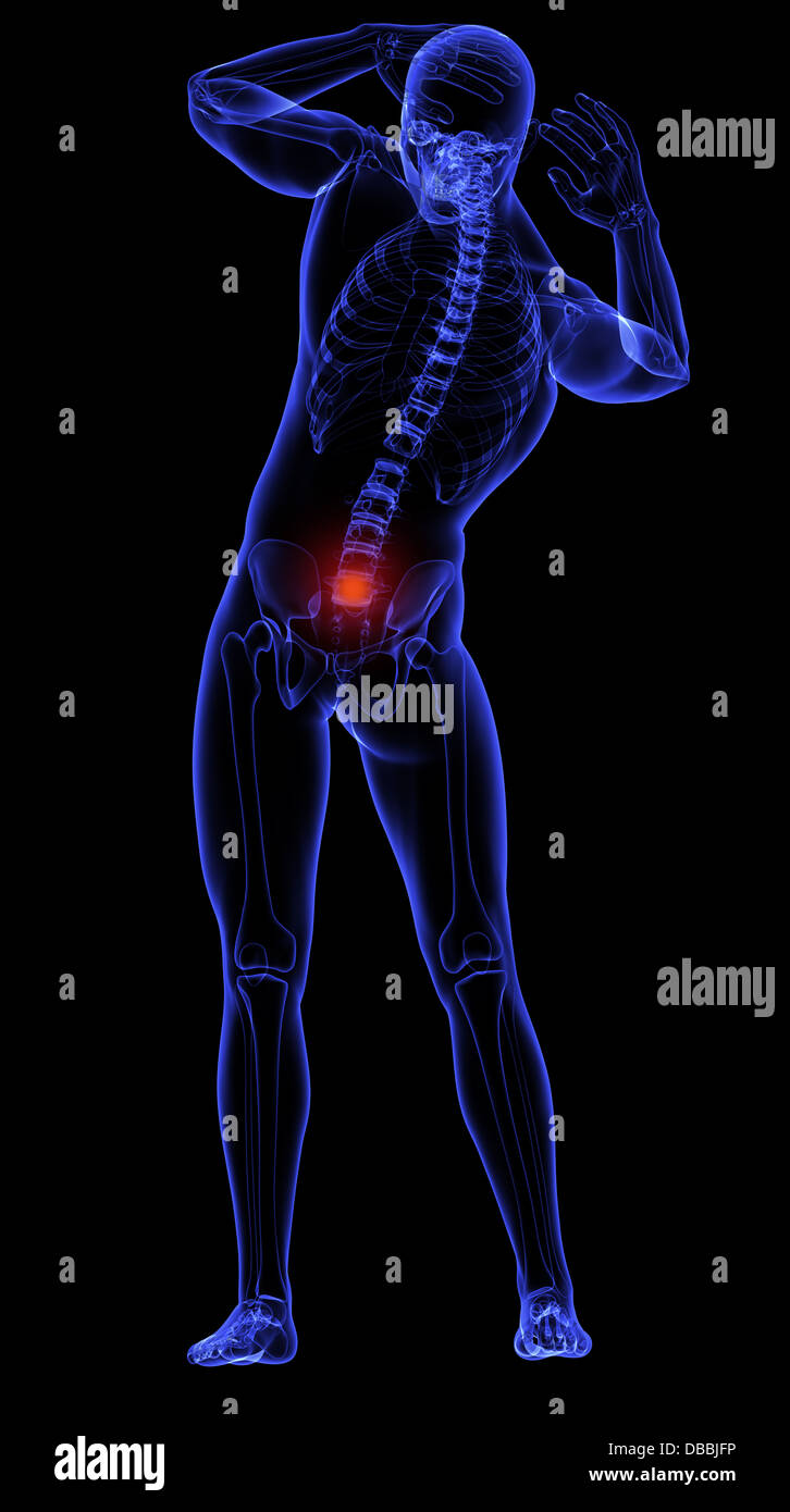 Human body with a visible pain in the lower back Stock Photo - Alamy