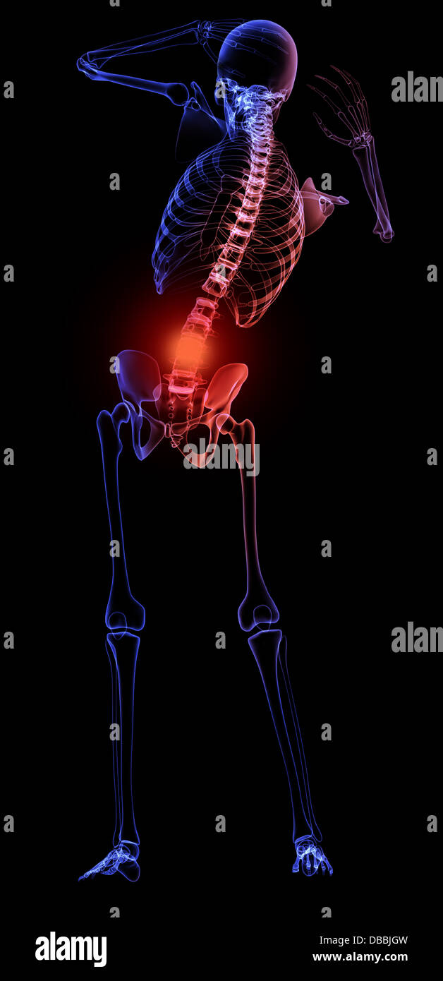Human skeleton with a visible pain in the lower back Stock Photo - Alamy