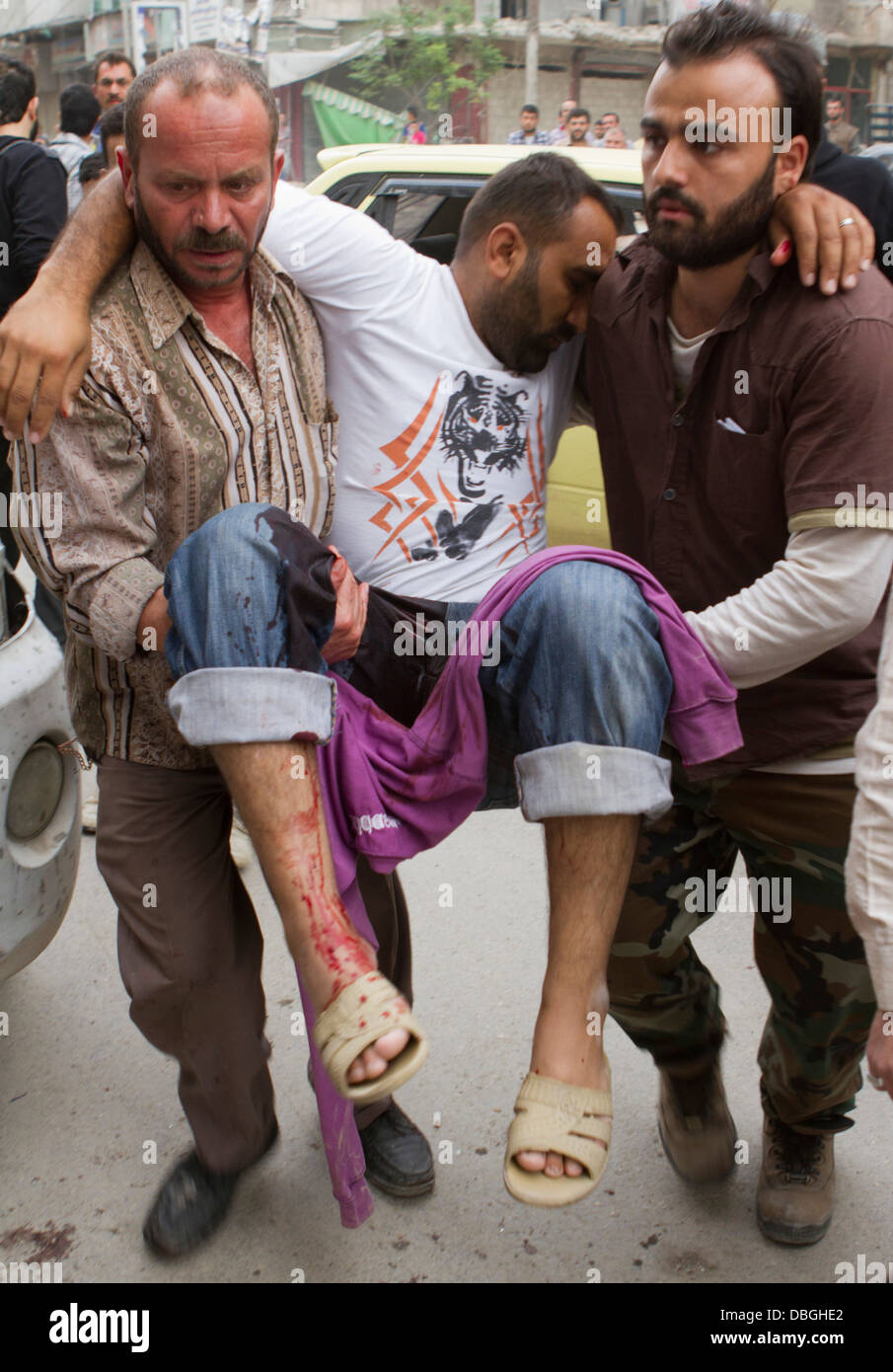 Wounded soldier revolutionary war hi-res stock photography and images ...