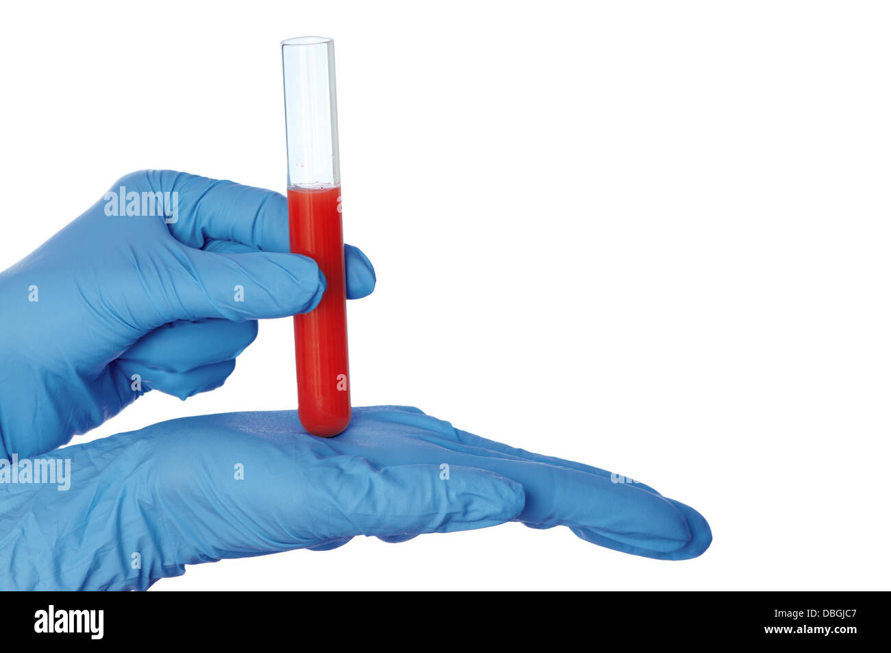 sample of bloods Stock Photo - Alamy