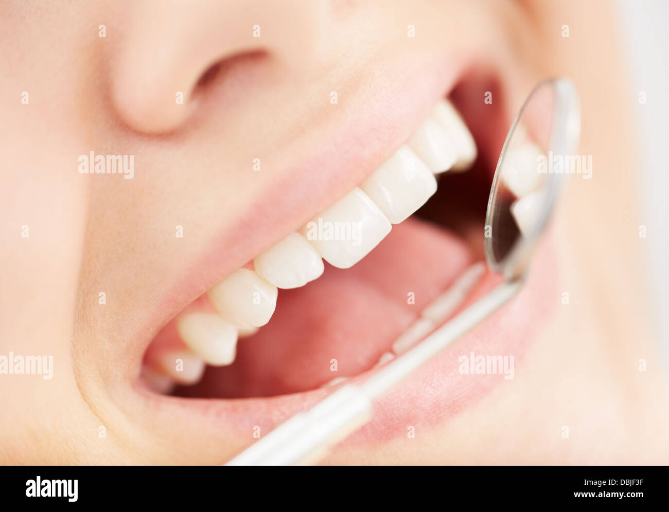 Open mouth during dental treatment hi-res stock photography and images ...