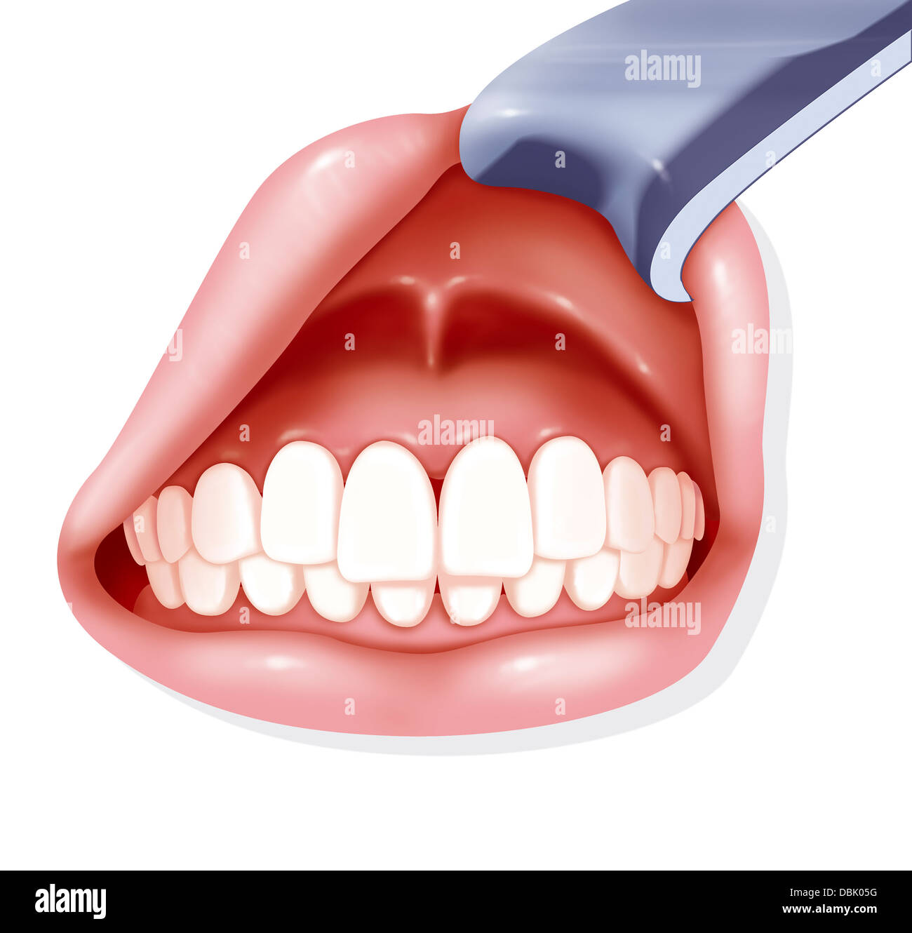 Frenulum Diagram