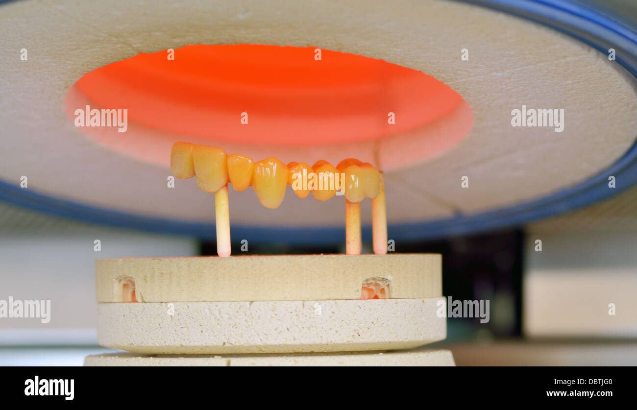 ceramic compound crowns in furnace inside of laboratory Stock Photo - Alamy