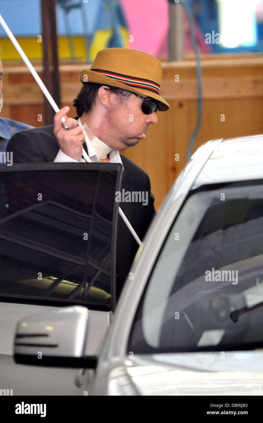 Face transplant recipient dallas wiens hi-res stock photography and ...