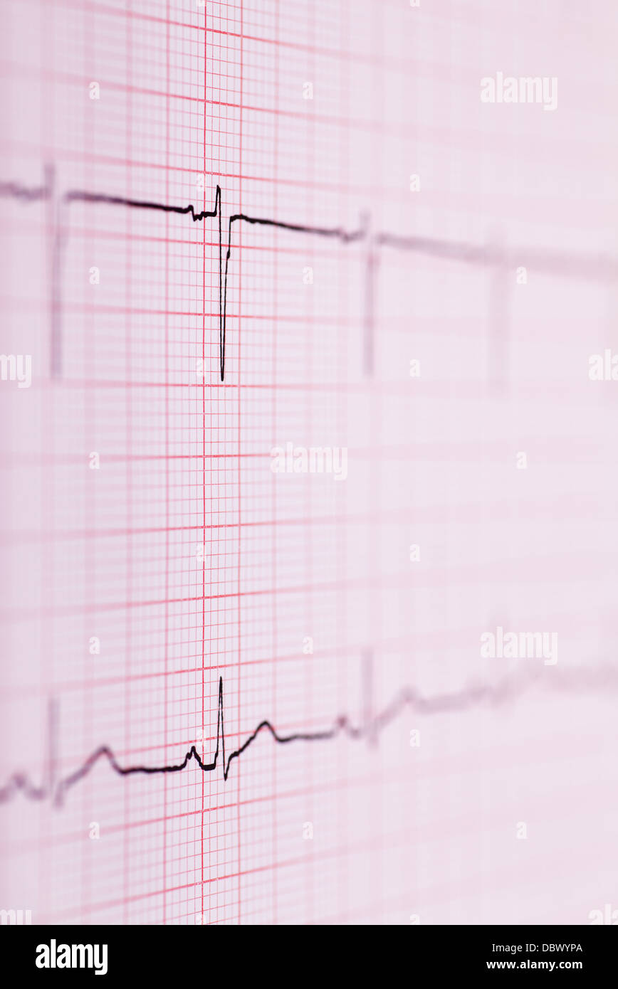 Ecg graph hi-res stock photography and images - Alamy
