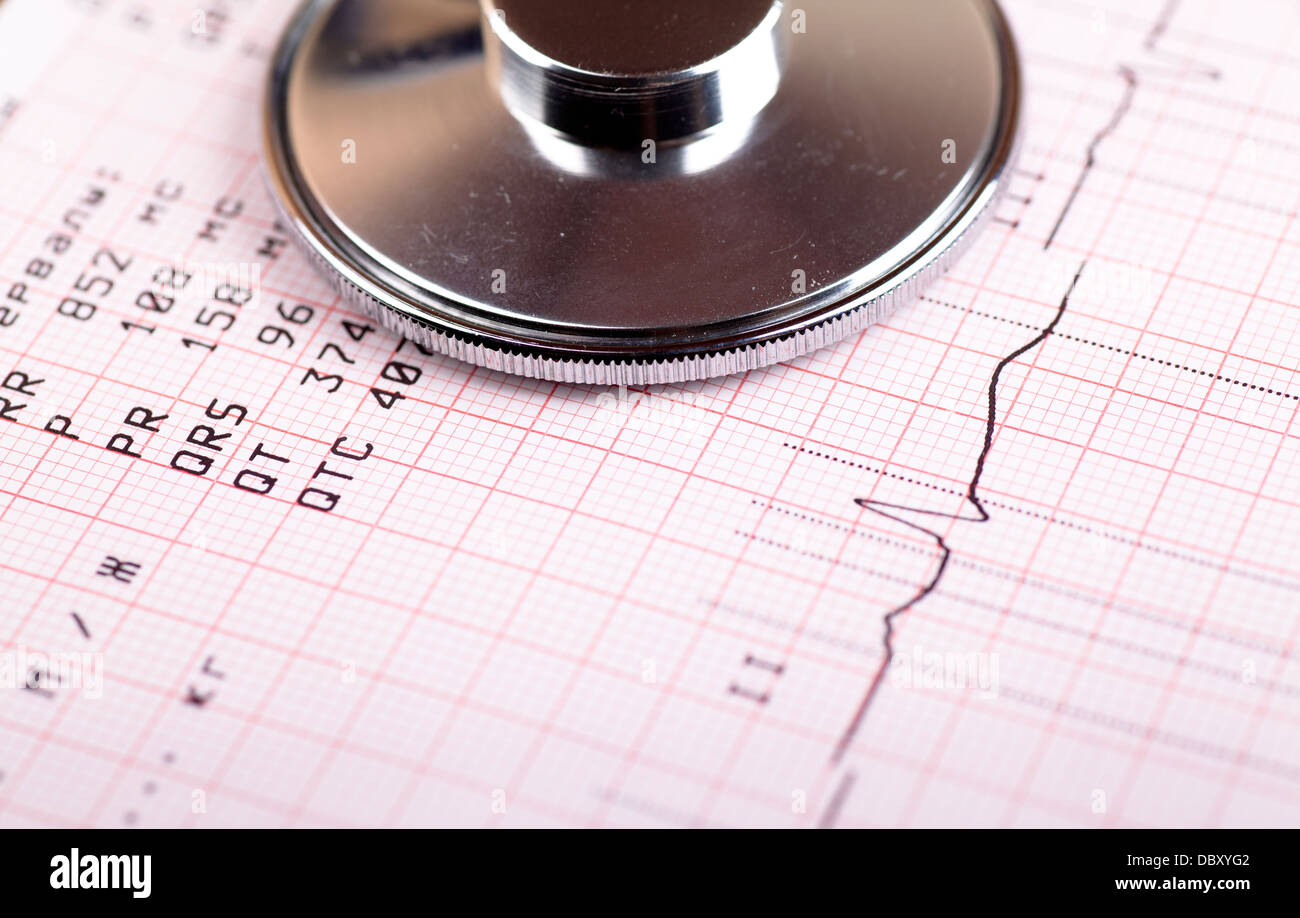 Ecg graph hi-res stock photography and images - Alamy