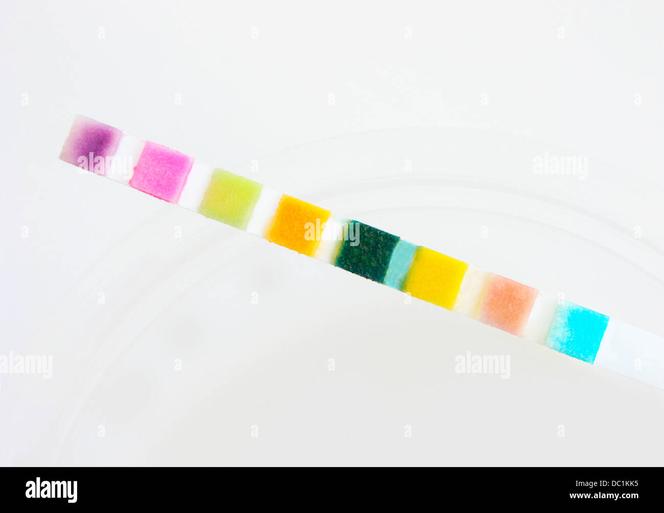 Reagent strip for urinalysis to check for bladder infections indicating ...