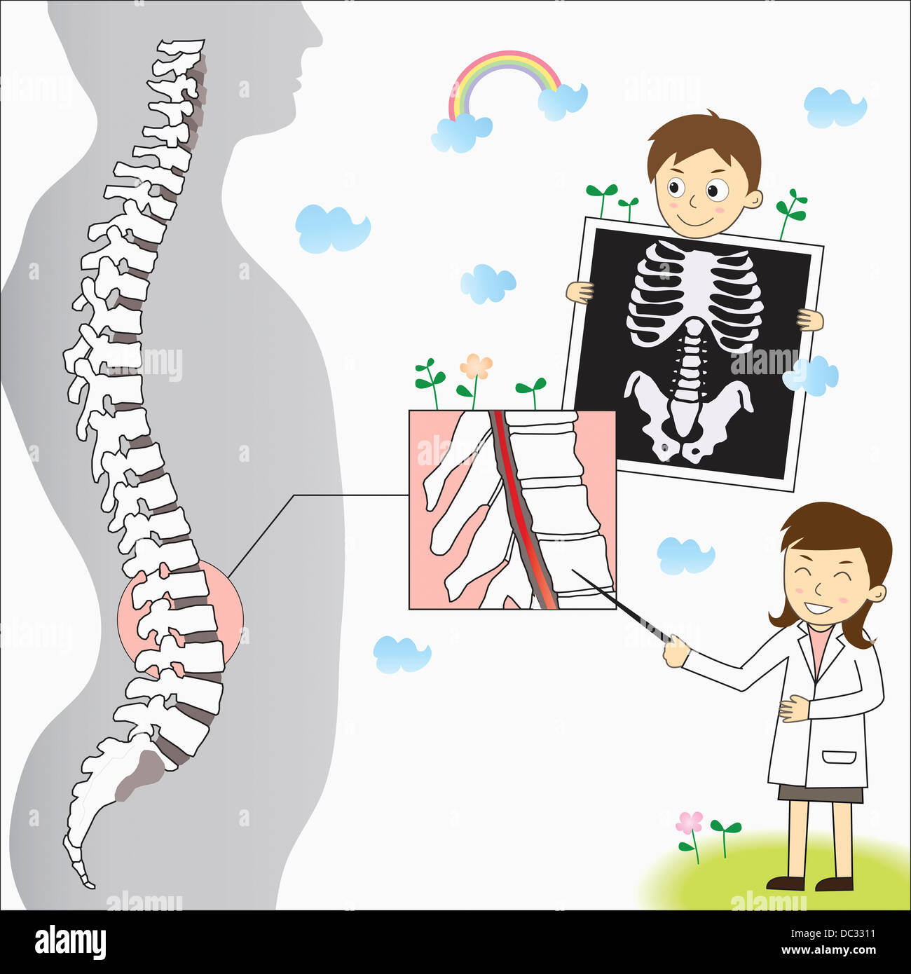 illustration of doctors and spine Stock Photo - Alamy