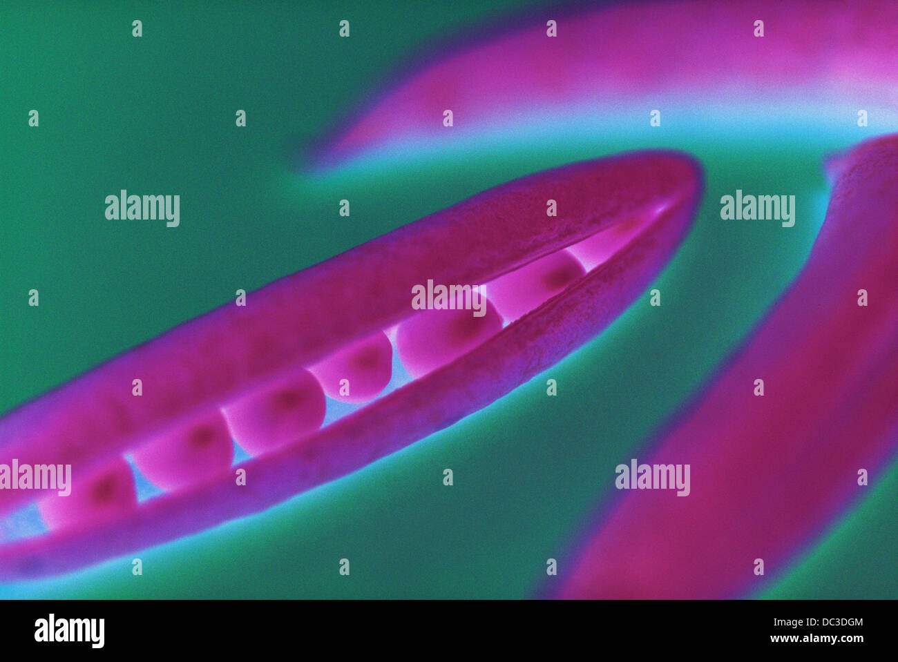 Negative effect food hi-res stock photography and images - Alamy