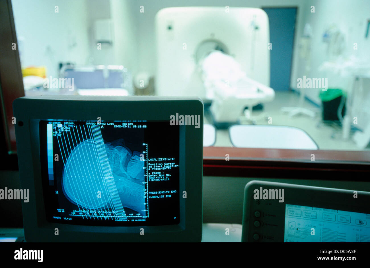 Computerized axial tomography scanner hi-res stock photography and ...