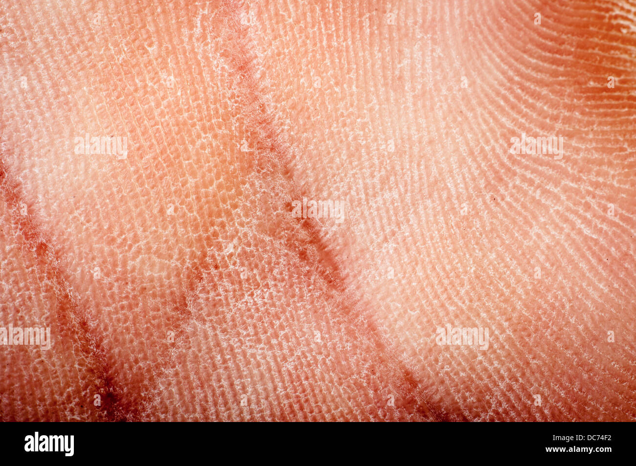 an image of human dried skin Stock Photo - Alamy