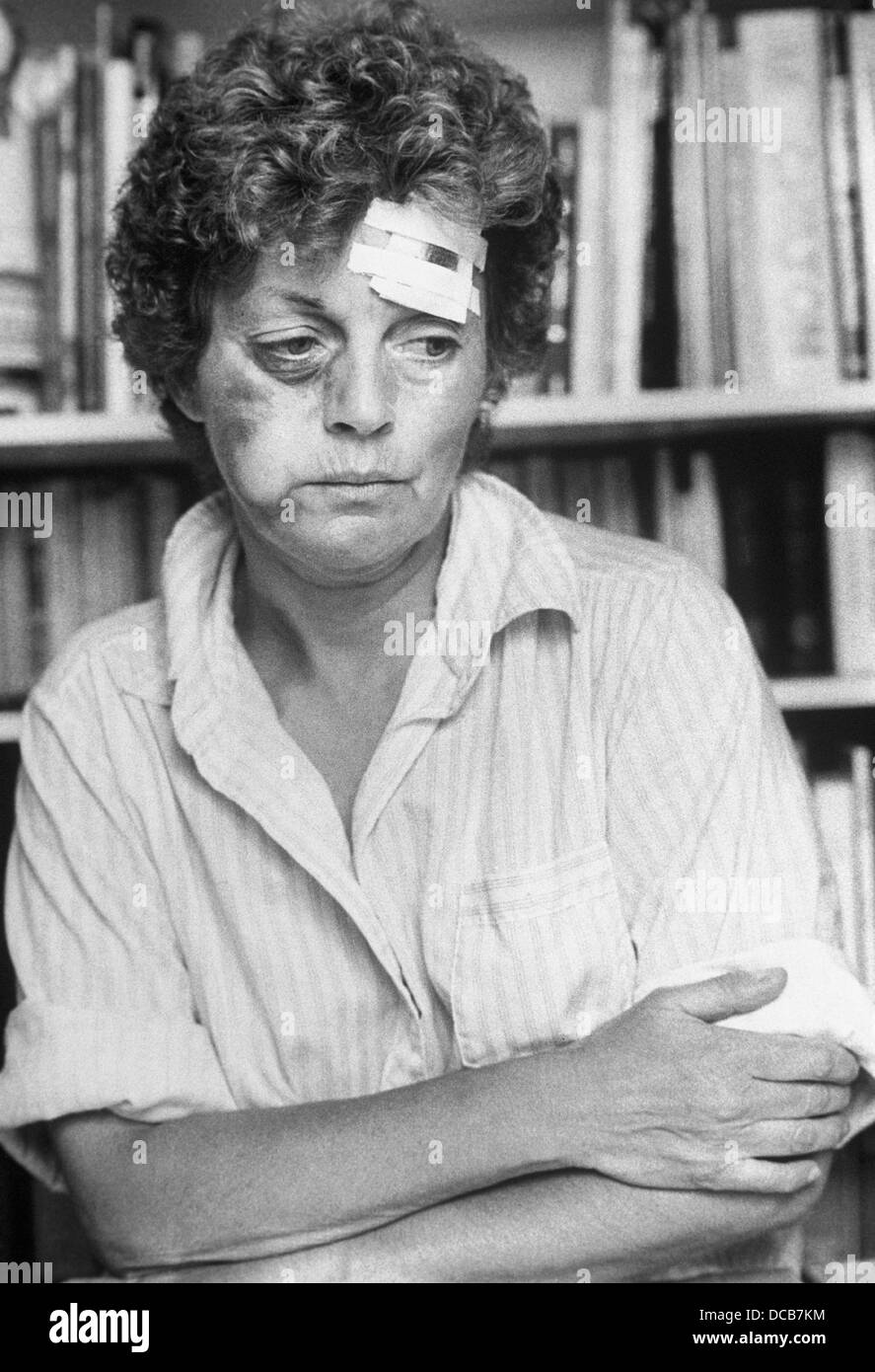 Bruised and battered hi-res stock photography and images - Alamy