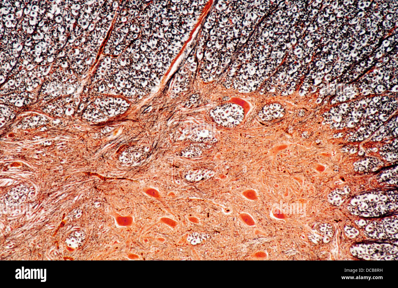 Nerve tissue hi-res stock photography and images - Alamy