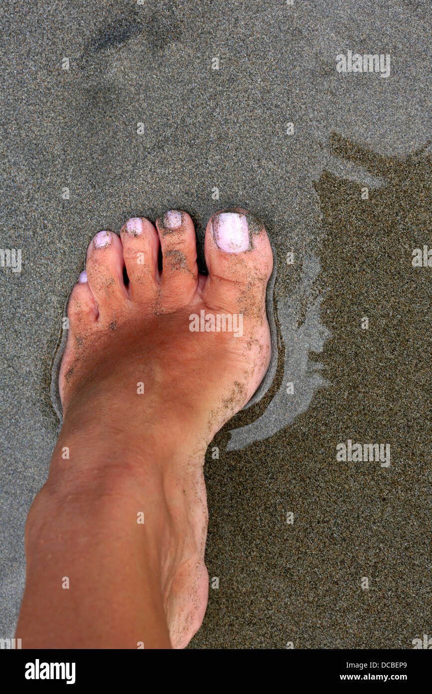 Sunburnt female leg Stock Photo - Alamy