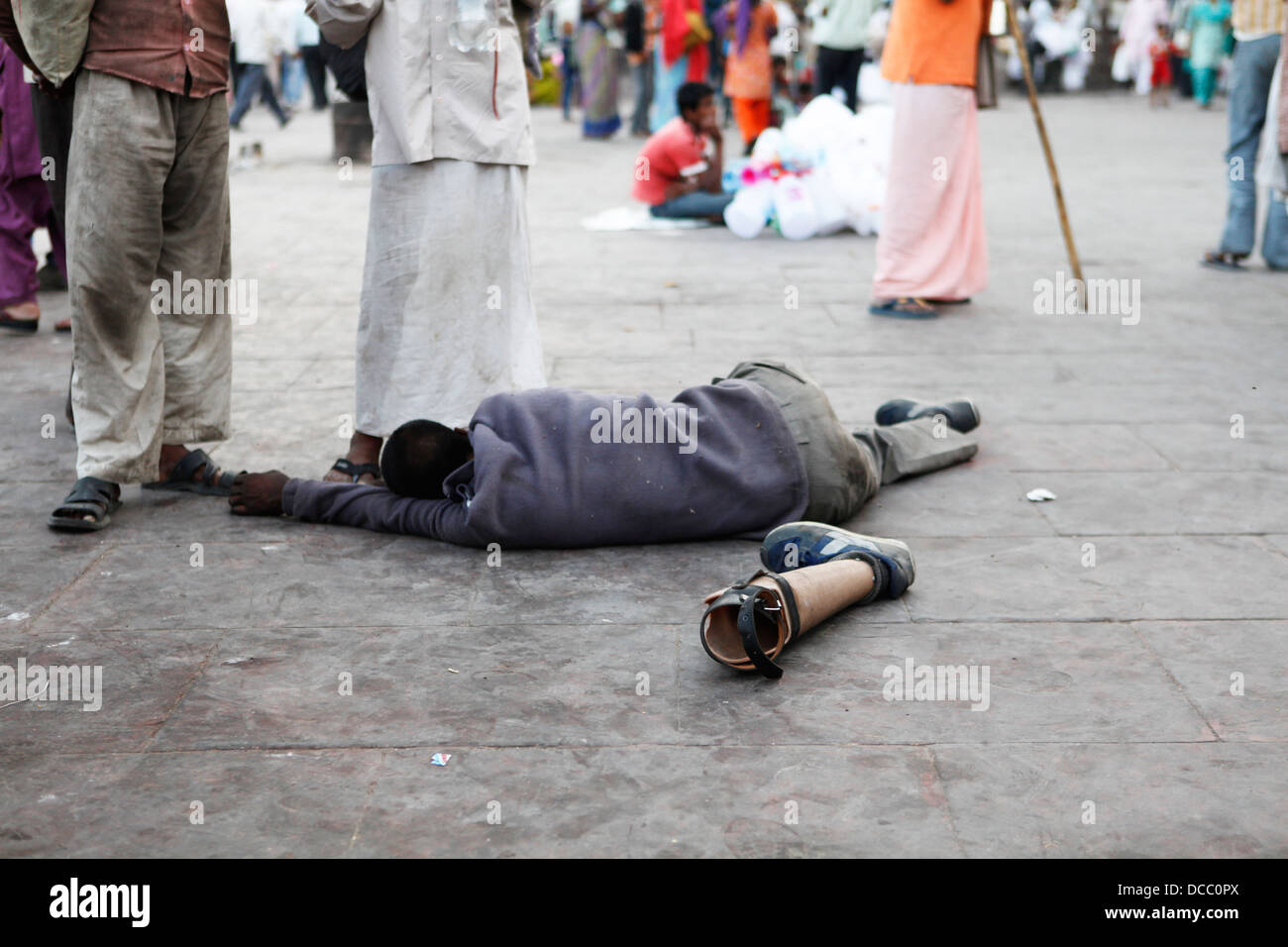 Prosthetic limb hi-res stock photography and images - Alamy