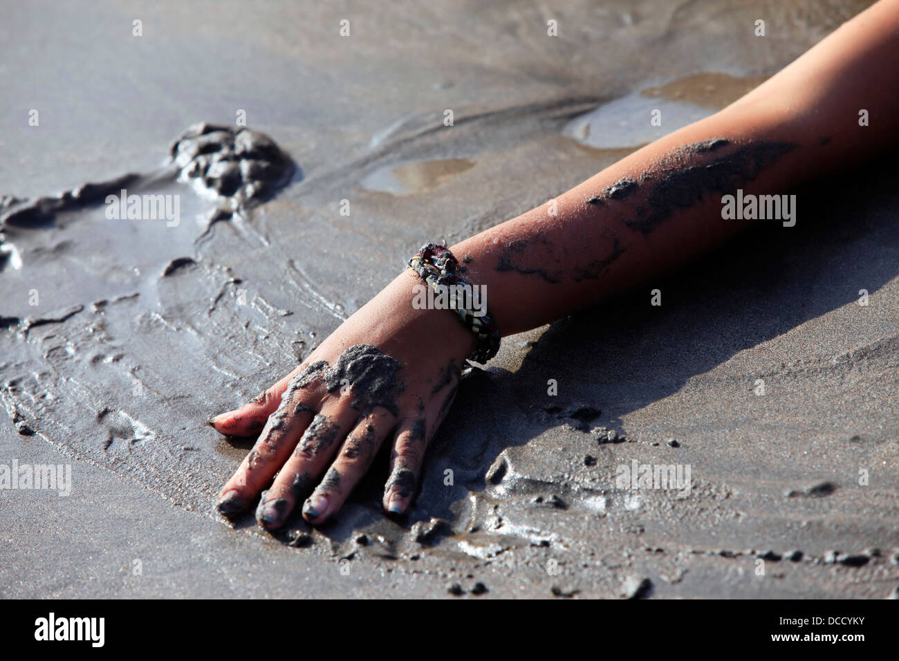 Sunburnt female hand Stock Photo - Alamy