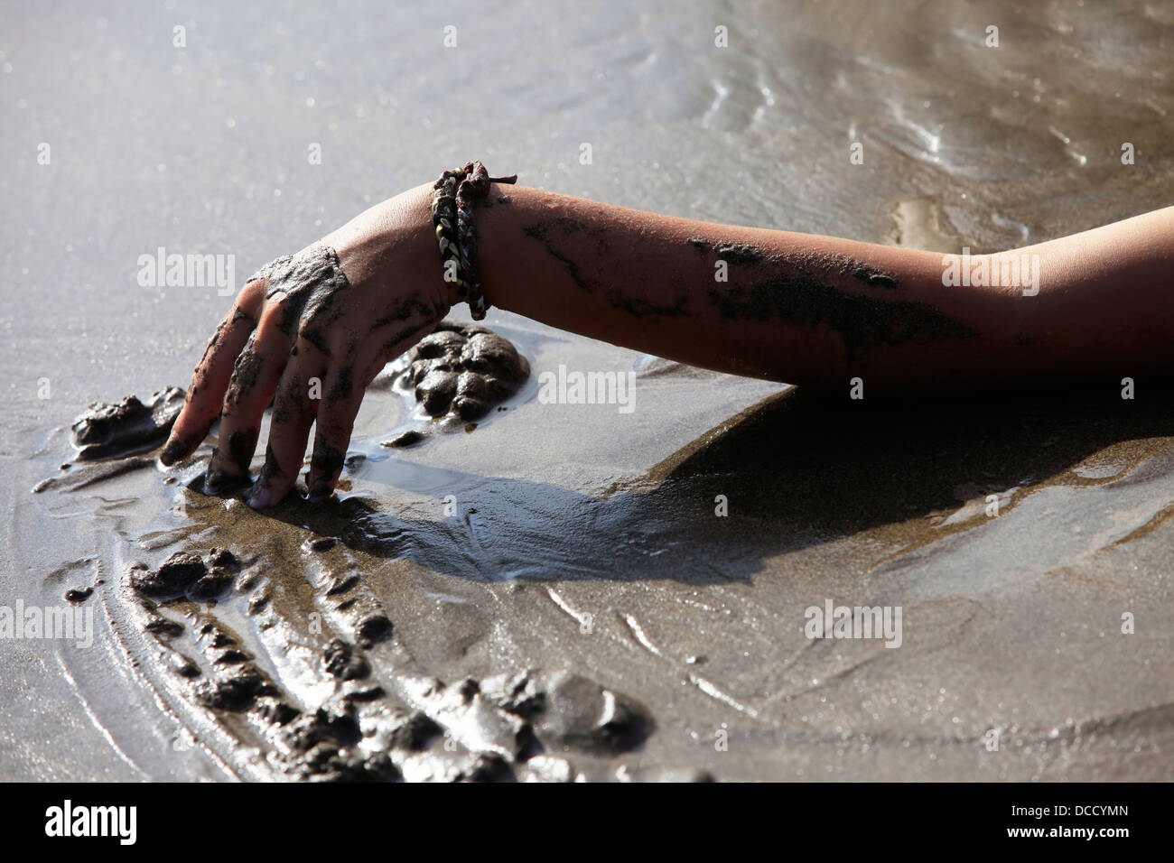 Sunburnt female hand Stock Photo - Alamy