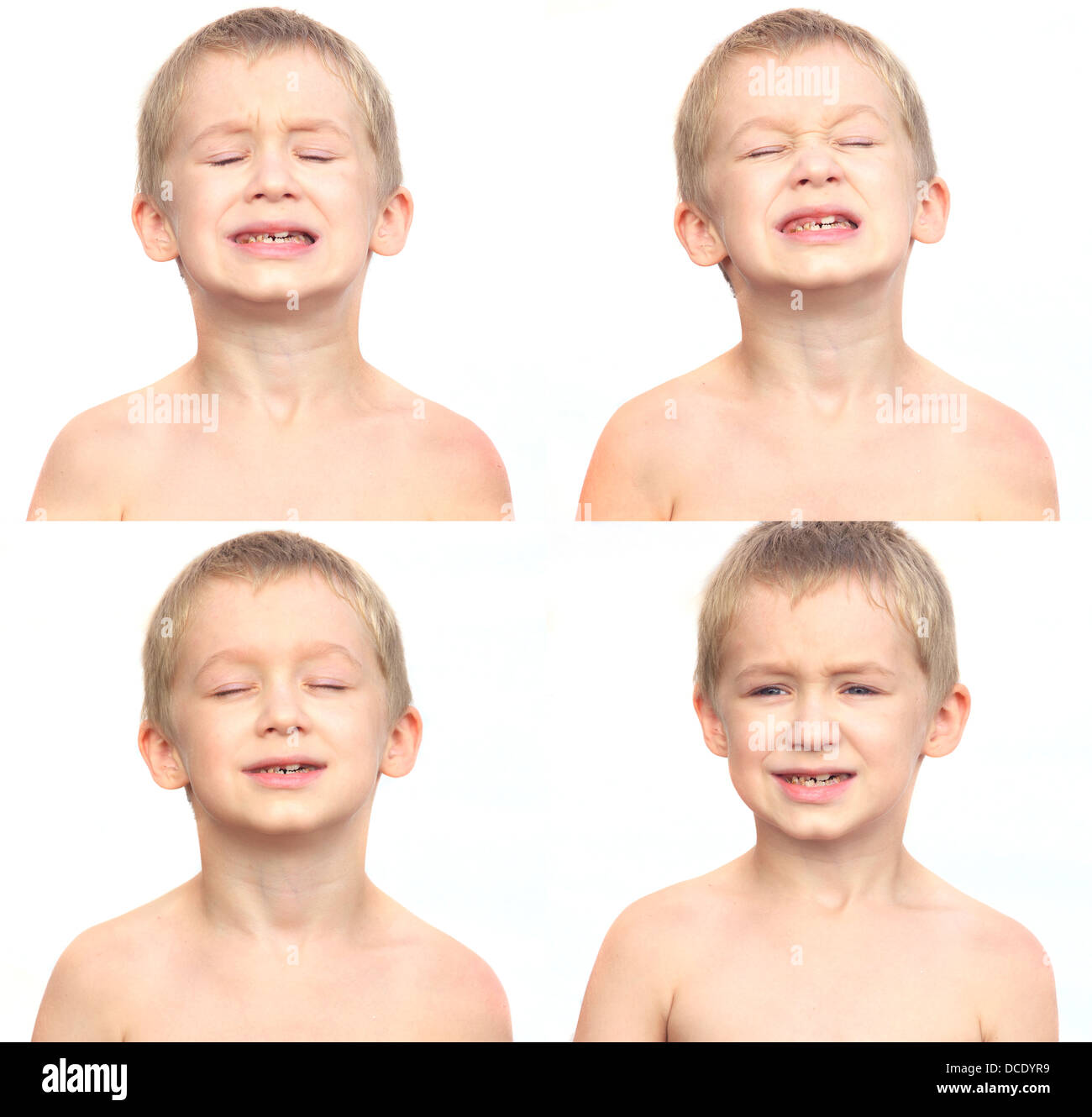 Little Boy Child making sore crying Faces showing Calf's Teeth Decay ...