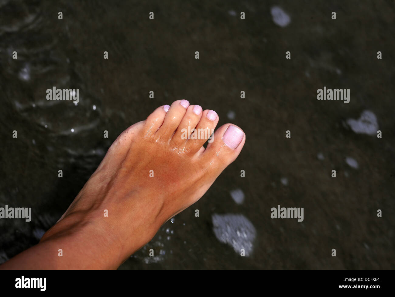 Sunburnt Legs High Resolution Stock Photography and Images - Alamy