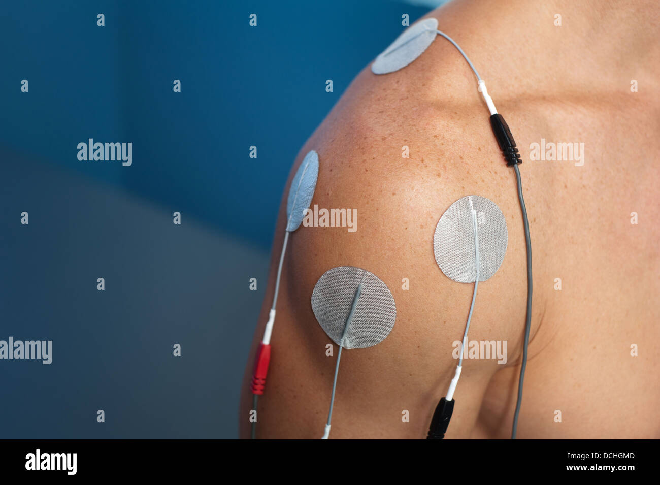 Rotator cuff injury hi-res stock photography and images - Alamy