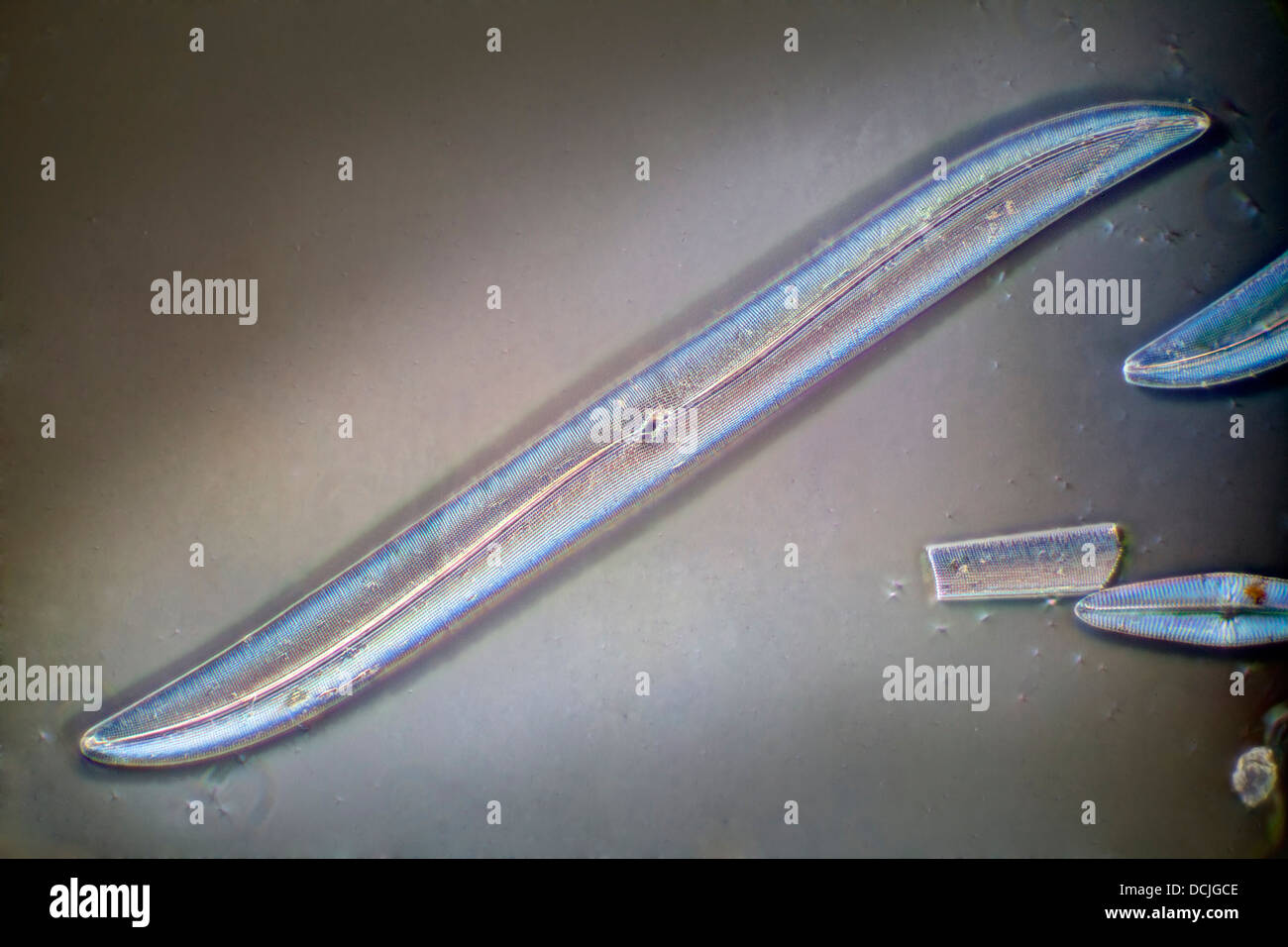 Pleurosigma balticum diatom, phase contrast photomicrograph Stock Photo ...