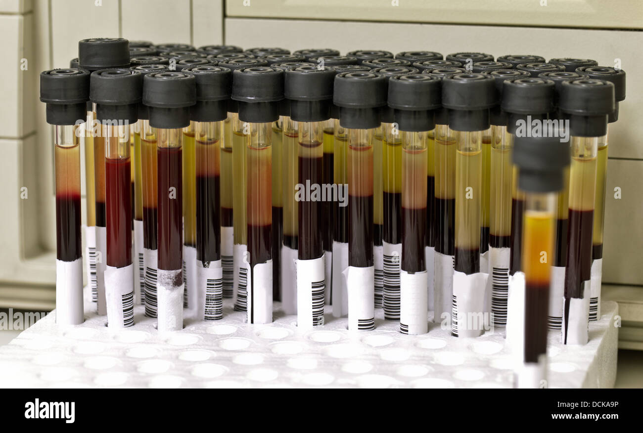 Blood samples tubes Stock Photo - Alamy