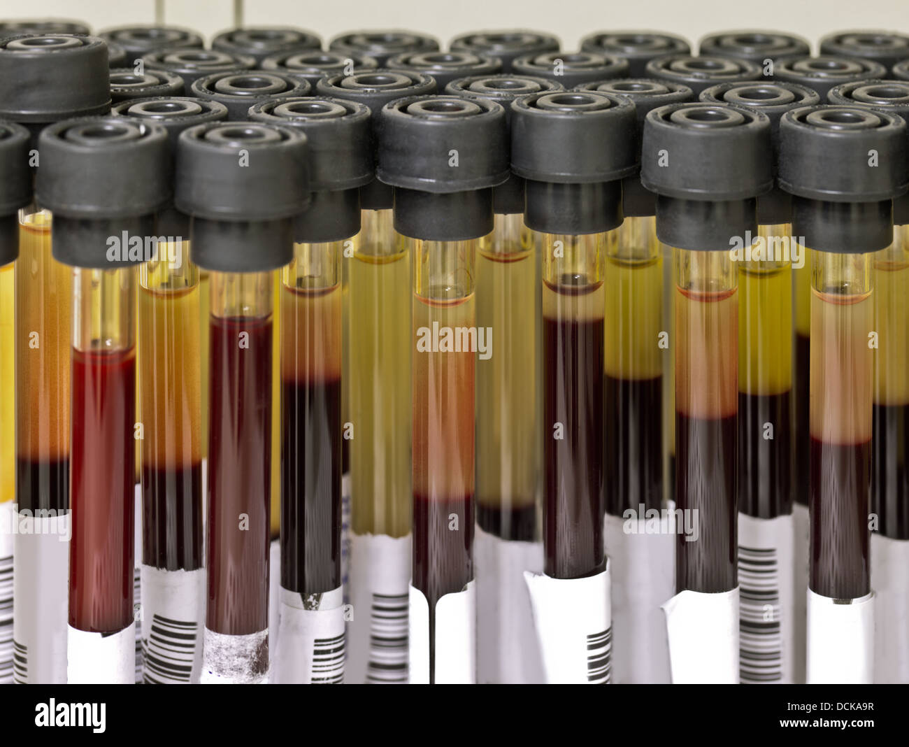 hospital blood test tubes Stock Photo - Alamy