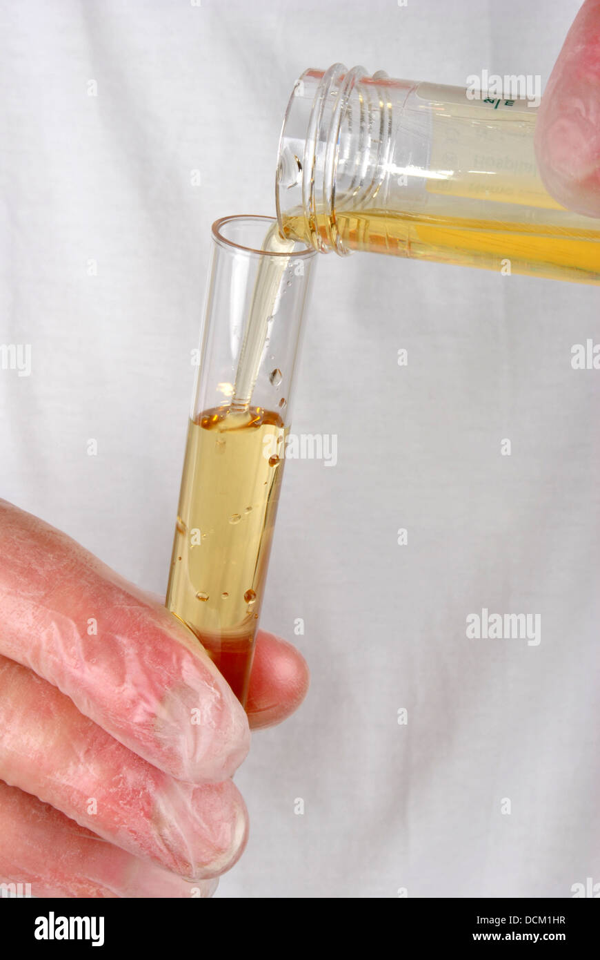 What Happens When You Leave Urine In A Bottle at Rose Slaughter blog