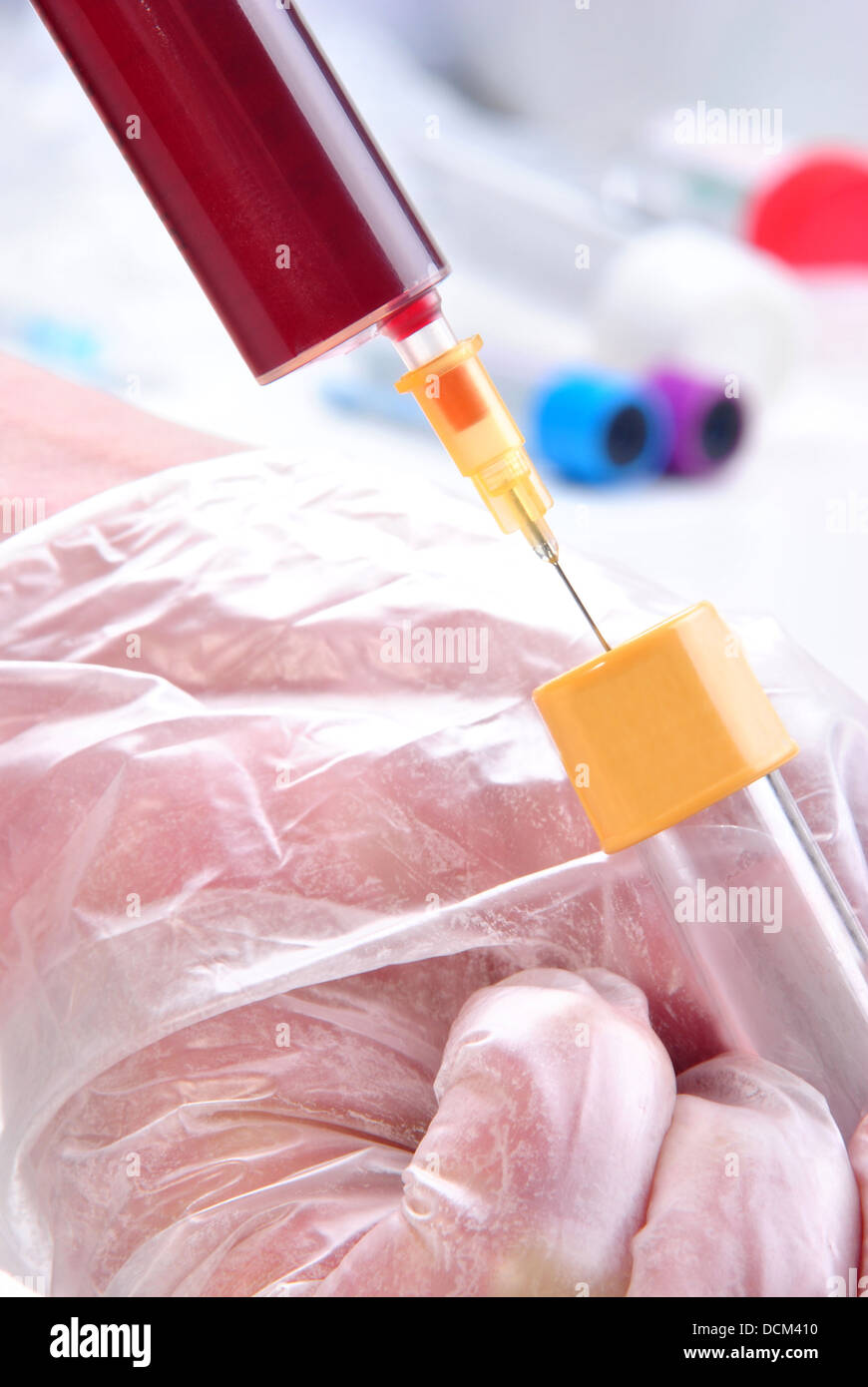 prepare some human blood for a test Stock Photo - Alamy