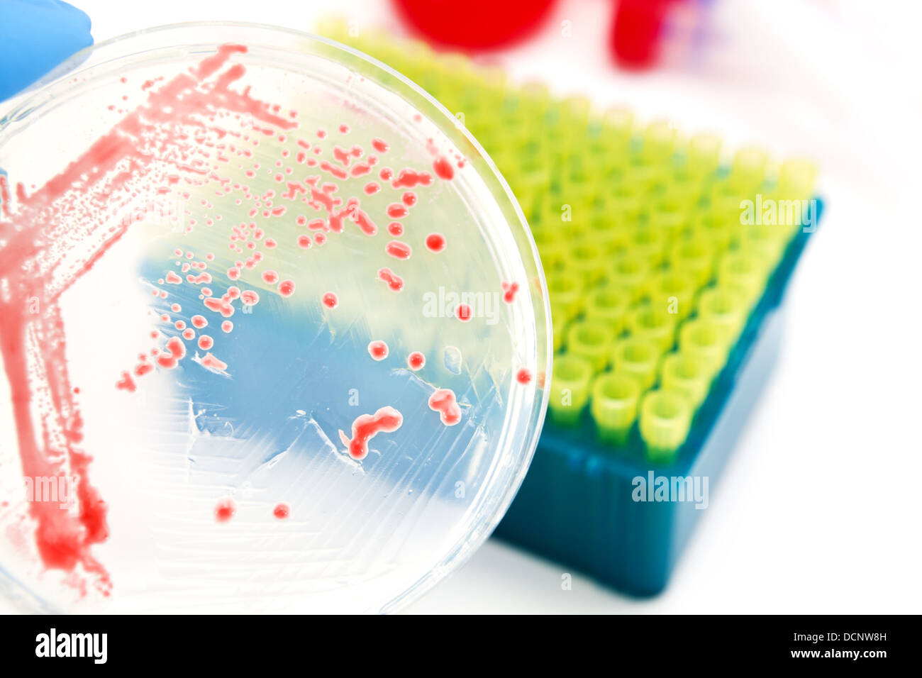 Microorganisms hi-res stock photography and images - Alamy