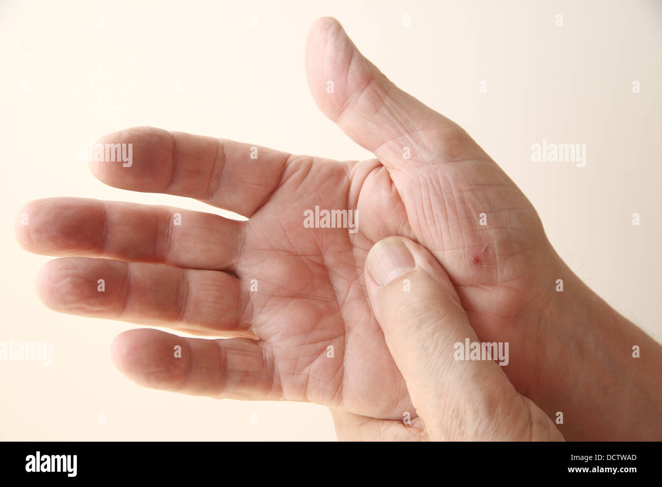 Skin healing hi-res stock photography and images - Alamy