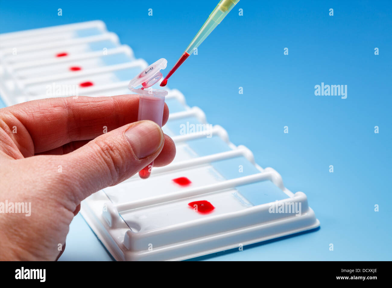 microbiological pipette in the genetic laboratory Stock Photo - Alamy