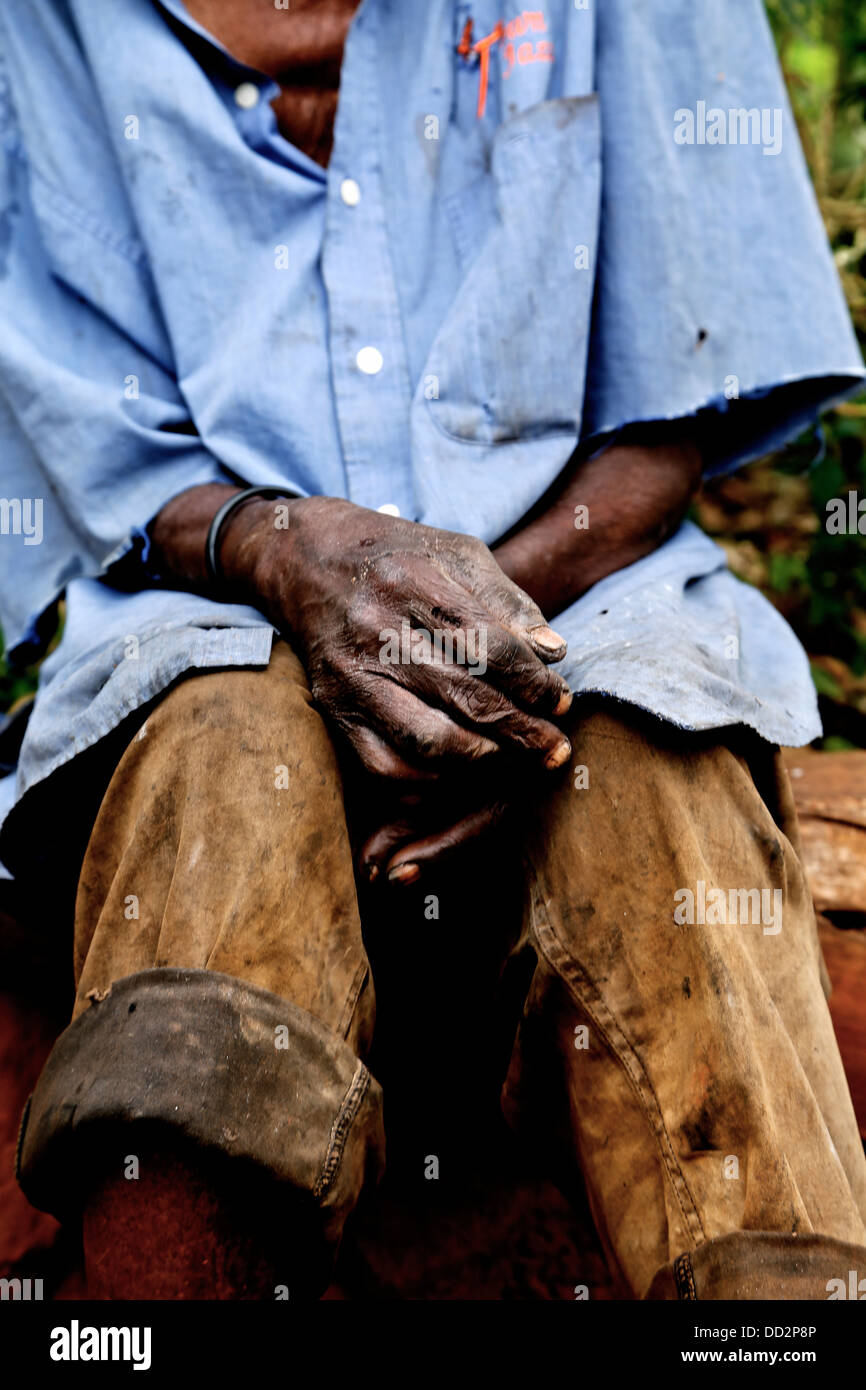 Photograph of male hands in lap taken in Uganda, Africa Stock Photo - Alamy